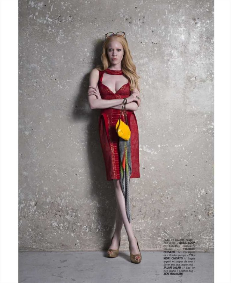 Albino Model Diandra Forrest features in FASHIZBLACK Magazine's ...