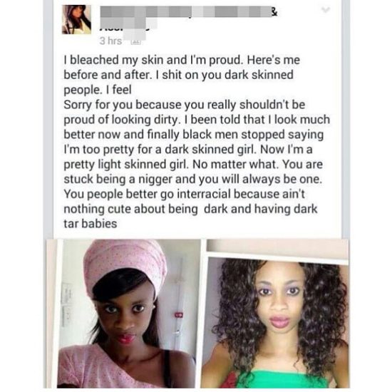 "Ain't nothing cute about being dark" Bleached Girl's Facebook Post ...