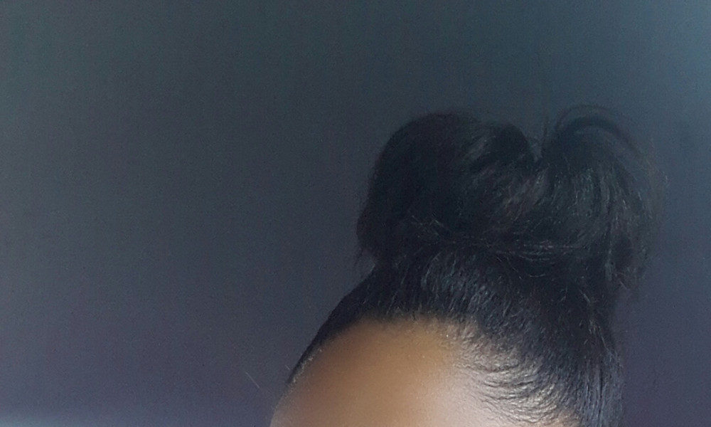 BN Beauty: "Help, I'm Losing My Hairline"! Find Out 7 Reasons Why You ...