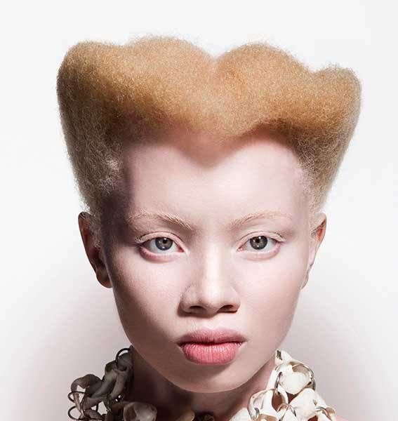 "I'm a Different Shade of Normal" - South African Albino Lawyer, Thando ...