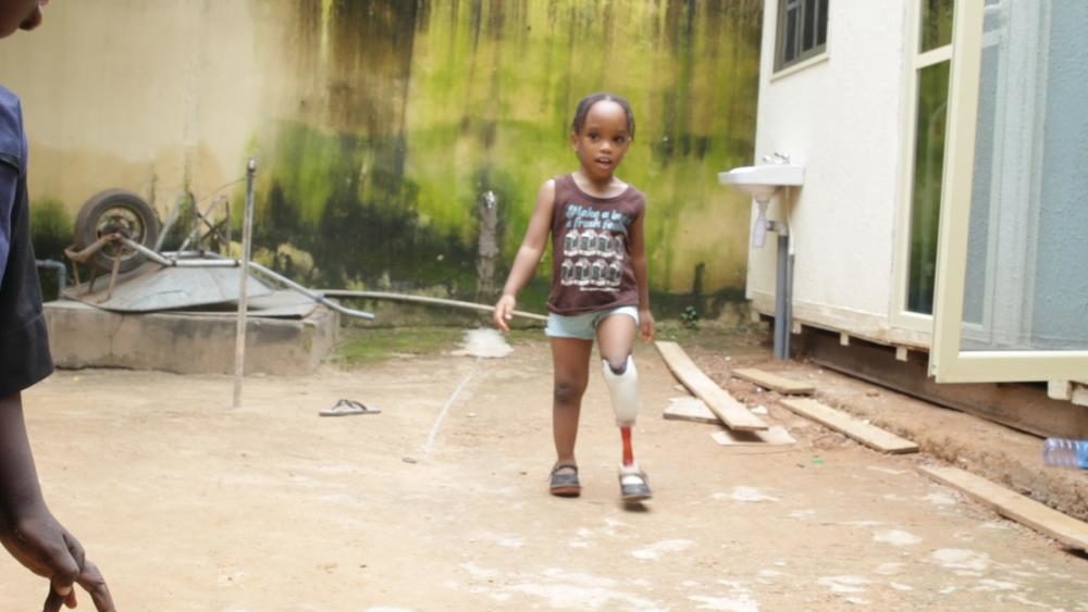 Stanbic IBTC Supports Children without Limbs with its #Together4ALimb ...