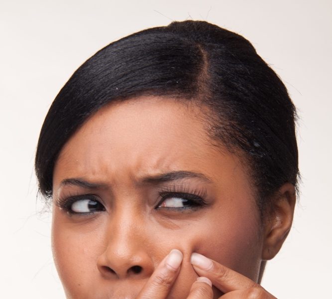 Lola Jay: An in depth Look at what ACNE Really is and How to Get Rid of ...