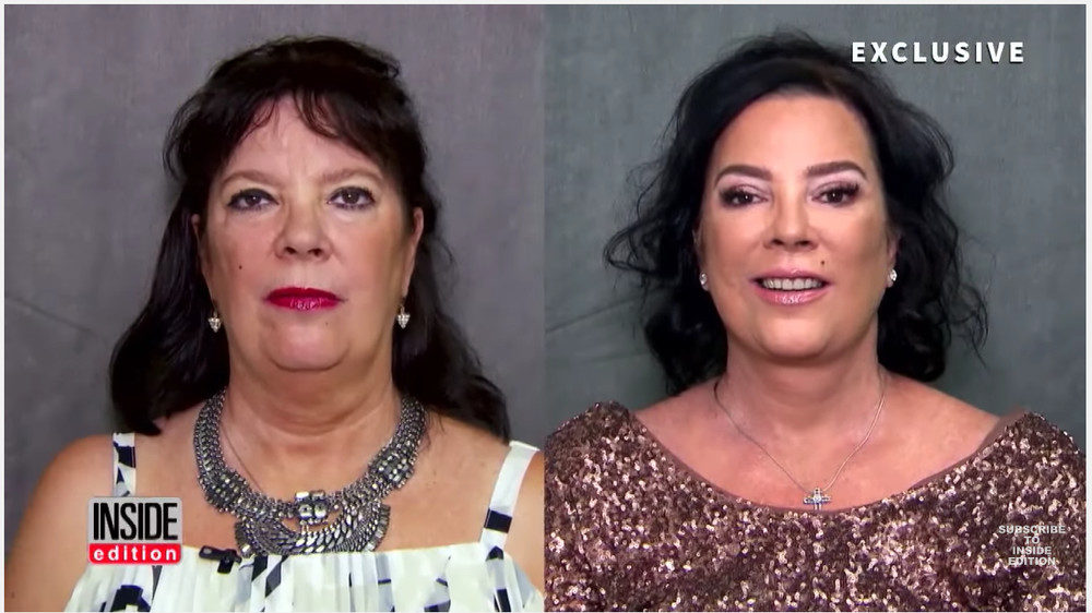 Kris Jenner's Sister Karen gets 5 Hour Facelift to Look Like Her! Watch ...