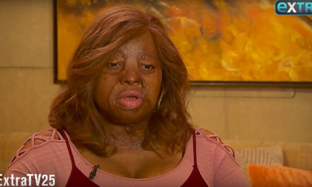 Kechi Okwuchi is so Brave & Inspiring! WATCH this Touching ExtraTV ...