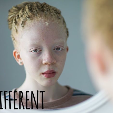 Yes, Albino Ladies Love Makeup Too! Ara by Laide & OAM Foundation raise ...