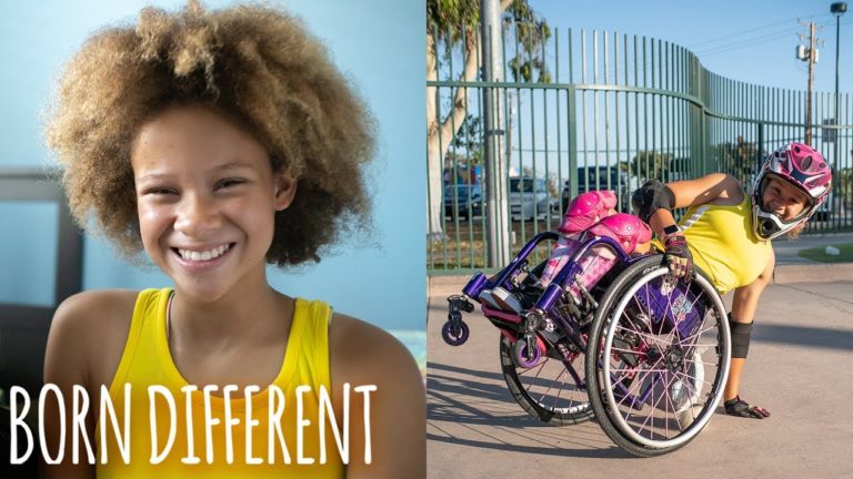 BN TV: This Girl was Born without a Fully Formed Spine & She's Not ...