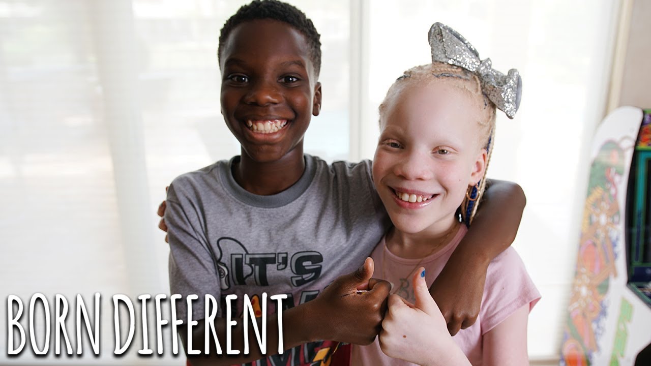 Born Different: 9-Year-Old She’riq was Born with Albinism & her Twin ...