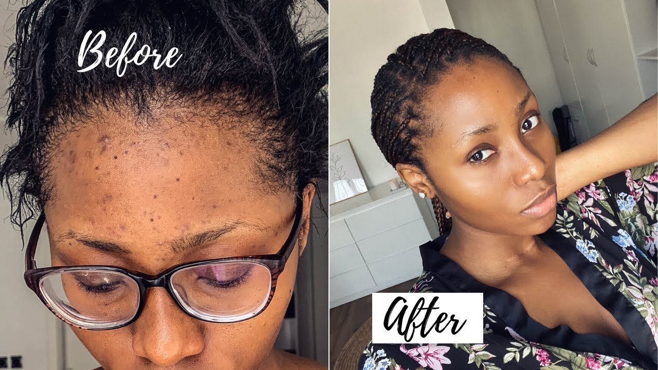 You Have to See Dimma Umeh's Skin Care Routine if you want a Healthy & Clear Skin | BellaNaija