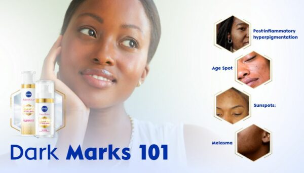 Say Hello to a Luminous Skin! Get to know the types of Dark Marks ...