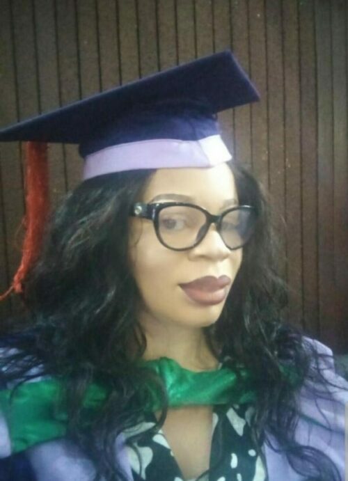 Joy Odigie On Living With Albinism, Overcoming Stigma & Empowering ...
